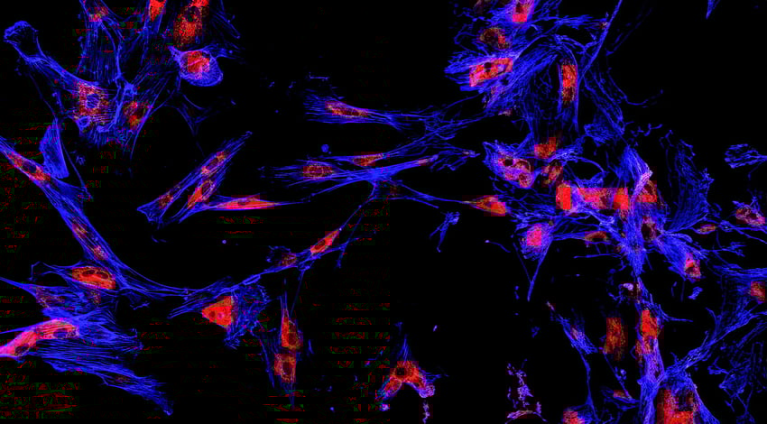 Multiplex Immunofluorescence | Precision for Medicine